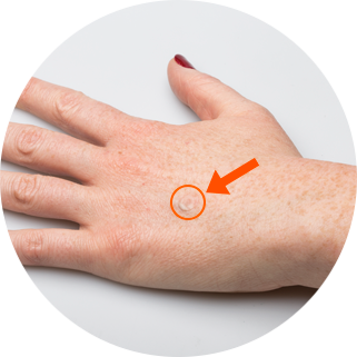 Needle-Free Injector Simple Steps for Painless IV